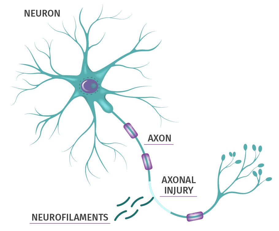 The Role of Neurofilaments in ALS